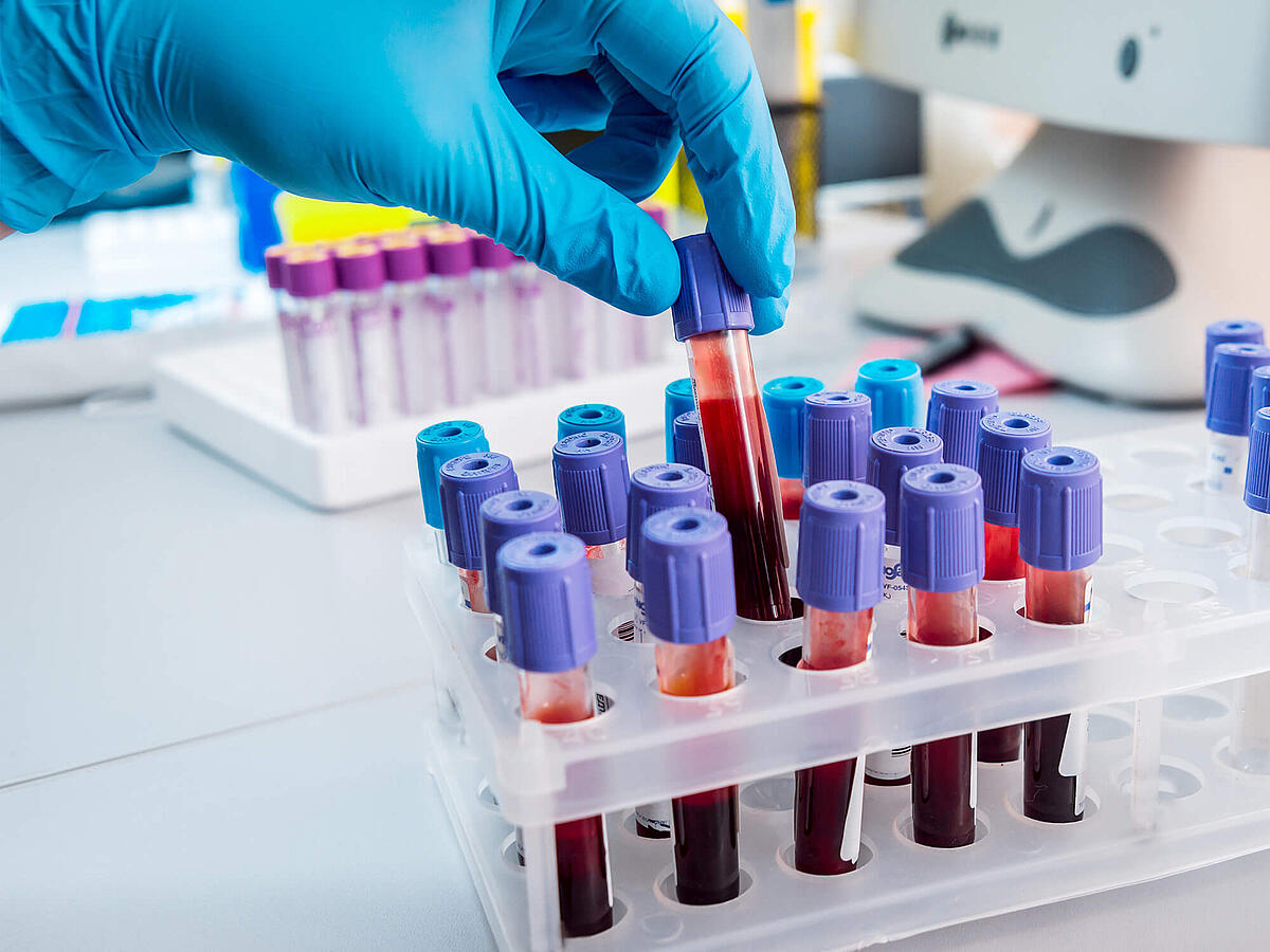 Blutwerte und was sie bedeuten